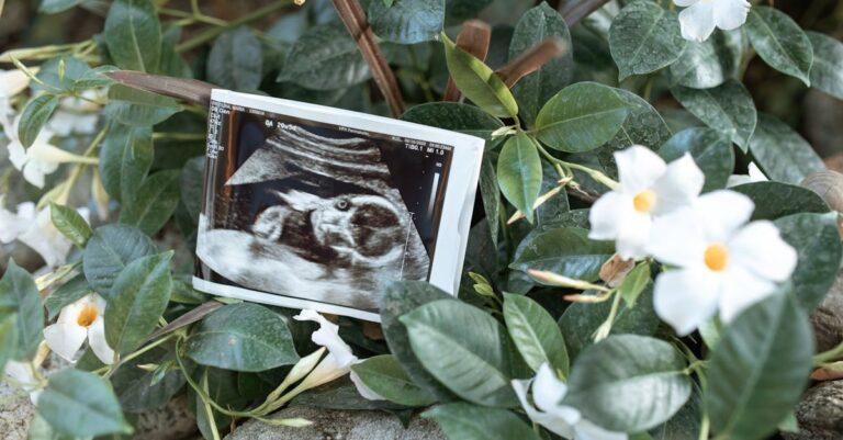 L'accouchement : déroulement étape par étape - Chroniquesdemaman